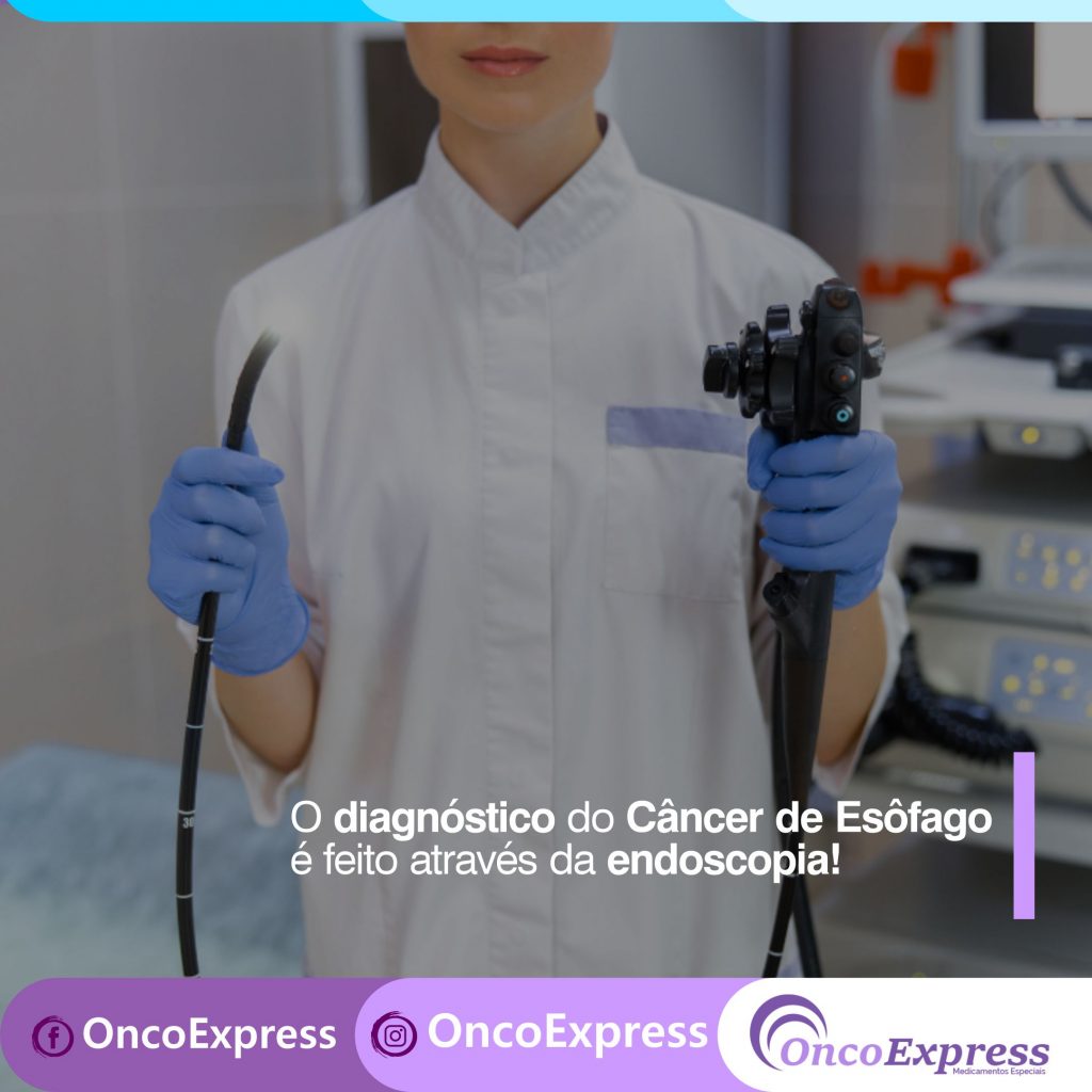 O diagnóstico do Câncer de Esôfago é feito através da endoscopia ...